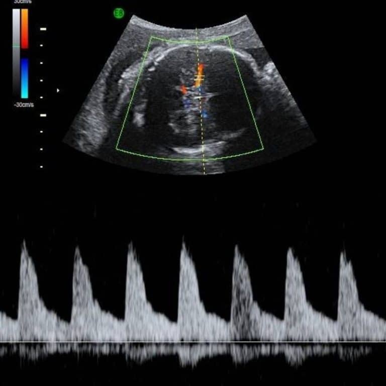 Ecografía Doppler Simple - Grupo VIVO