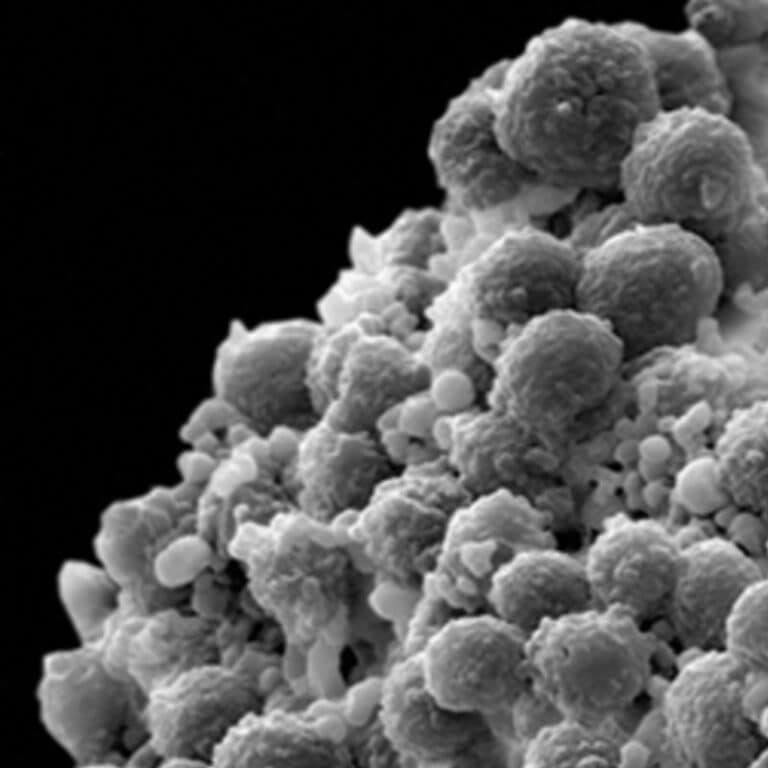 RM Multiparamétrica + Biopsia de Próstata por Fusión - Grupo VIVO